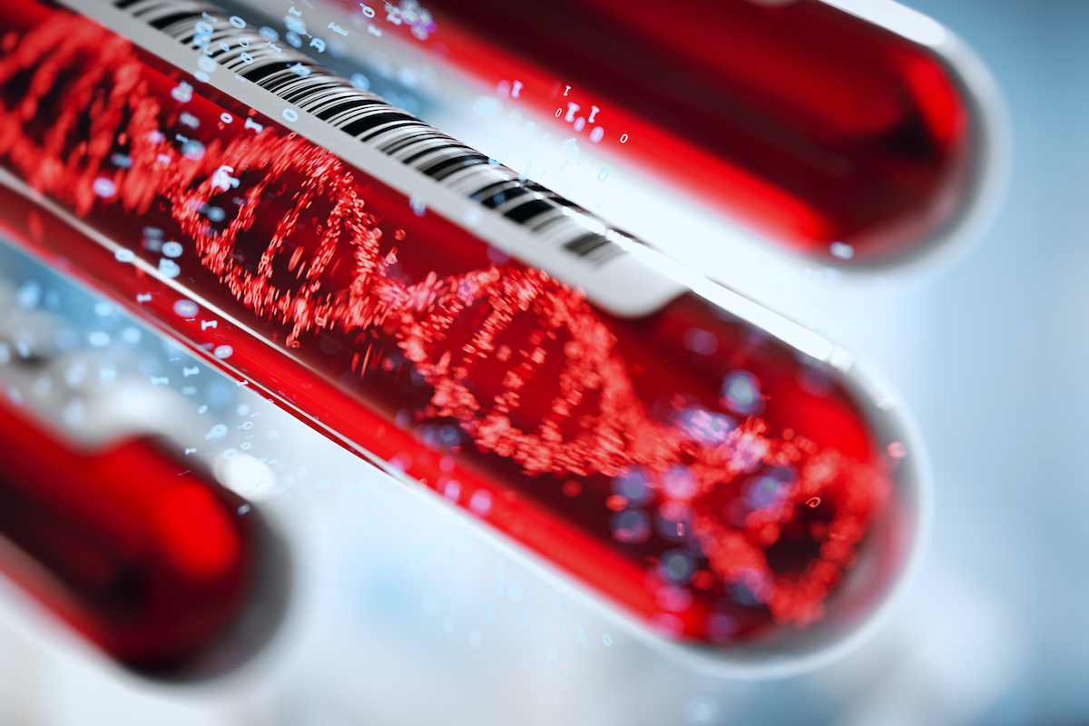 Gastric Cancer Foundation Blood Based Test Could Help Identify Hard to Gastric Cancer Foundation Blood Based Test Could Help Identify Hard to